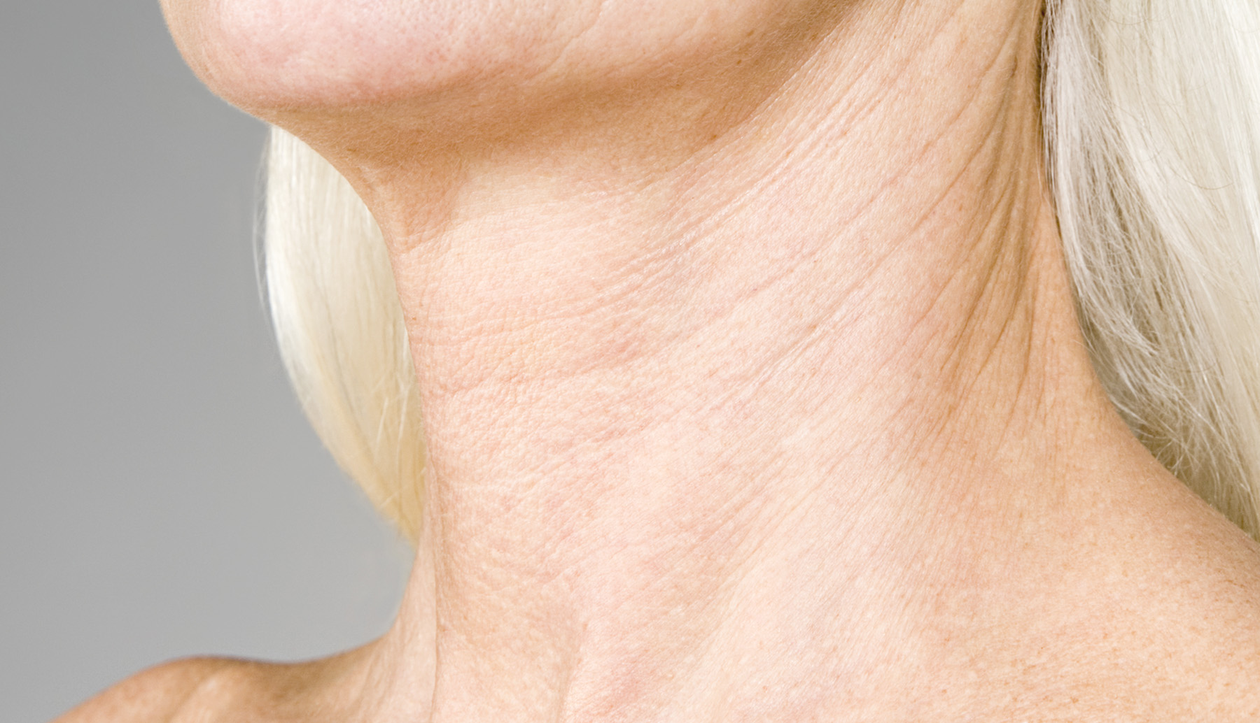 Sagging Neck Treatment Twickenham | Thames Skin Clinic