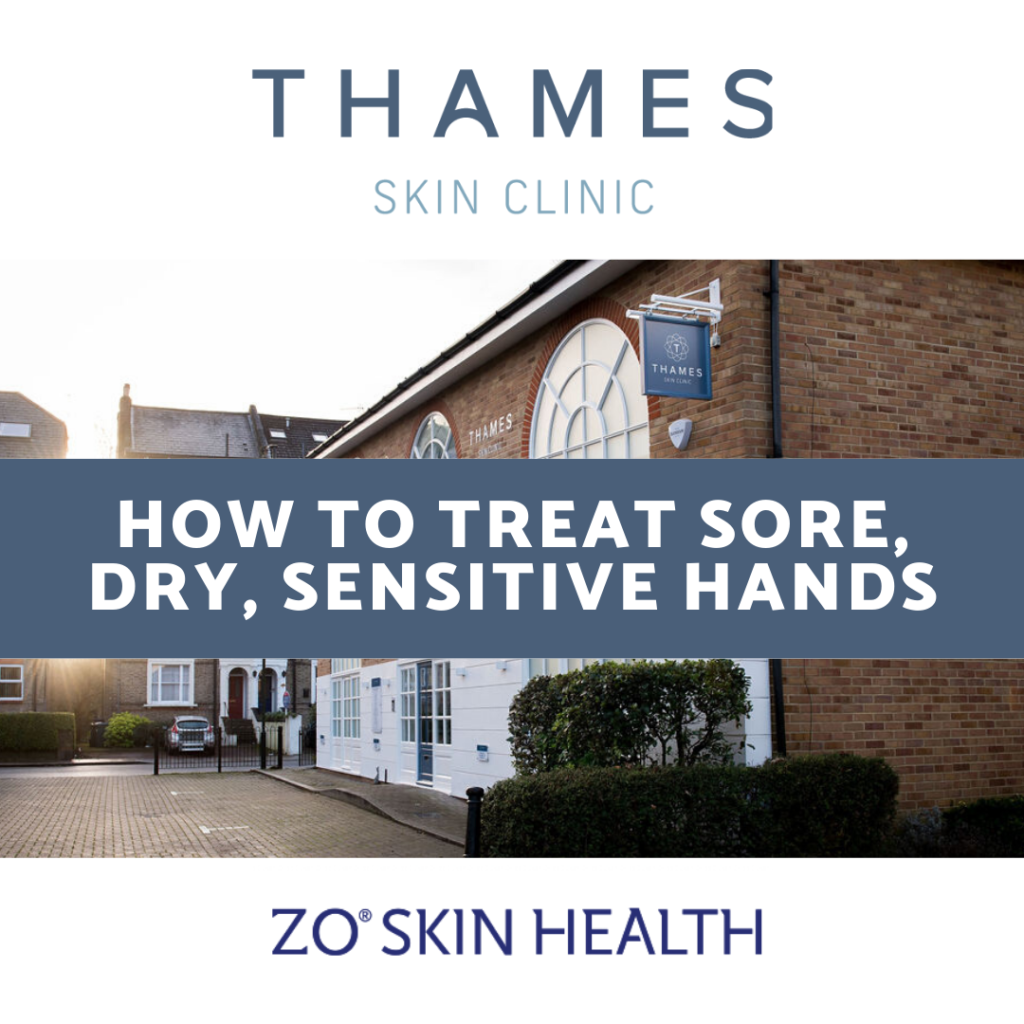 How to care for sore, dry, sensitive hands - Thames Skin Clinic