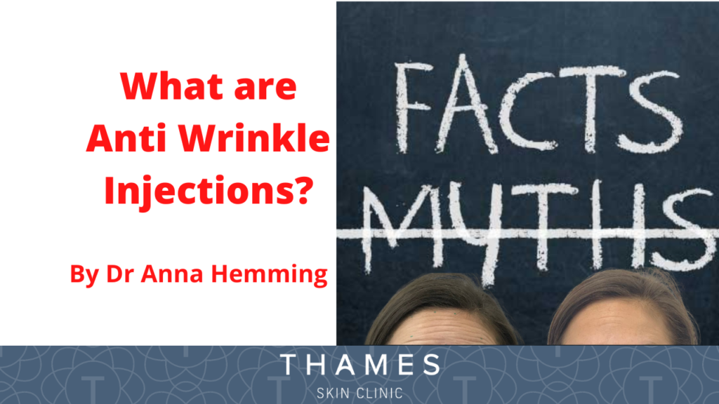What are anti wrinkle injections? - Thames Skin Clinic