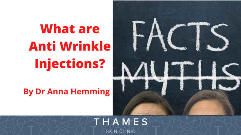 What are anti wrinkle injections? - Thames Skin Clinic